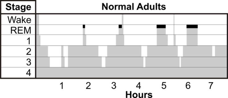 Schlafprobleme: Ursachen und Lösungen | mindyourlife